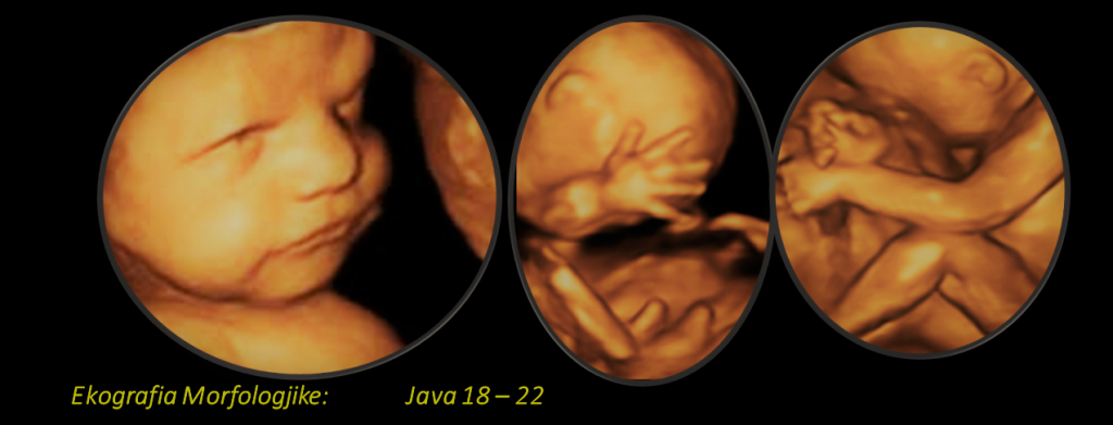 Ekografia Morfologjike | Dr.Elton Peci