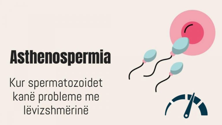 Asthenozoospermia | Dr.Elton Peci