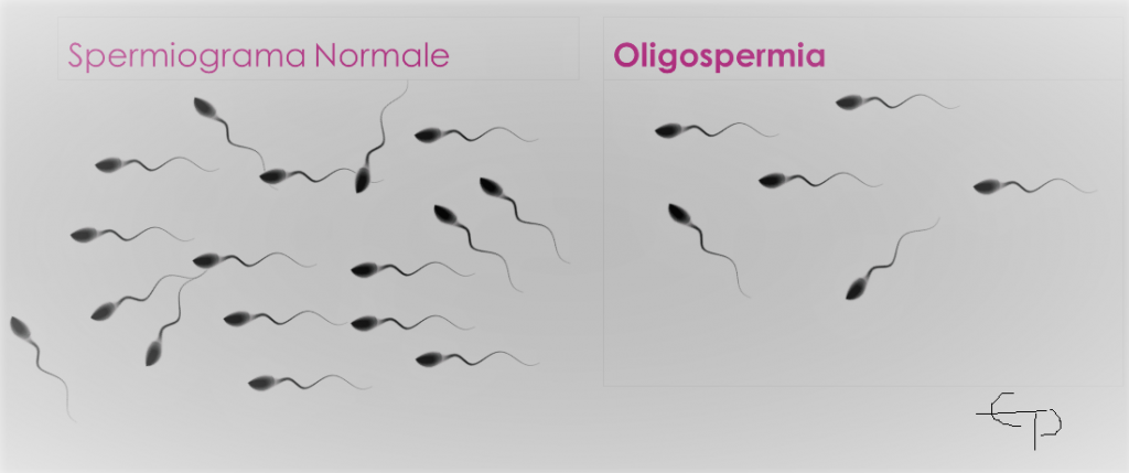 Oligospermia | Dr.Elton Peci