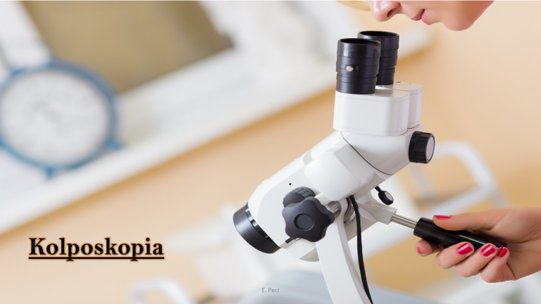 Kolposkopia | Dr.Elton Peci