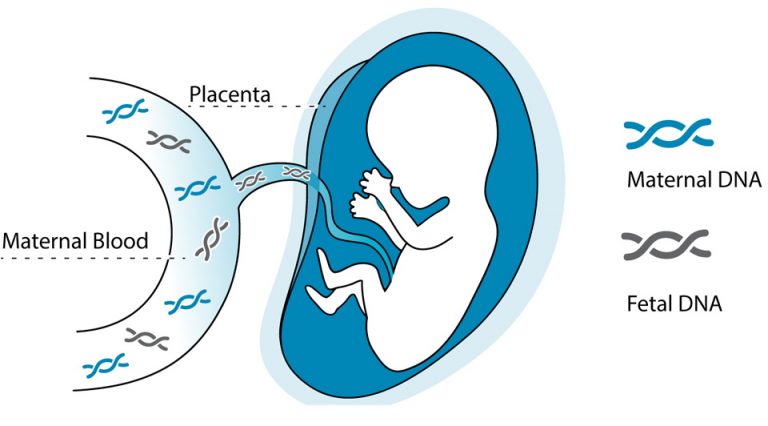 NIPT | Dr.Elton Peci